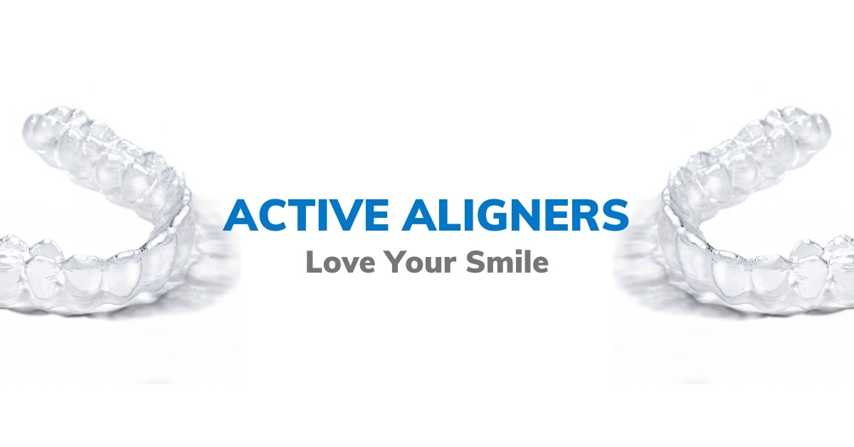 Active Aligners - Smile Club